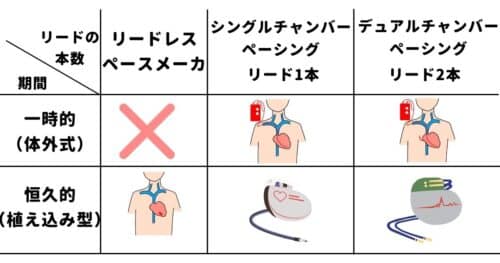 【ペースメーカーの看護】適応疾患から合併症・日常生活の注意点まで ハートナースの備忘禄